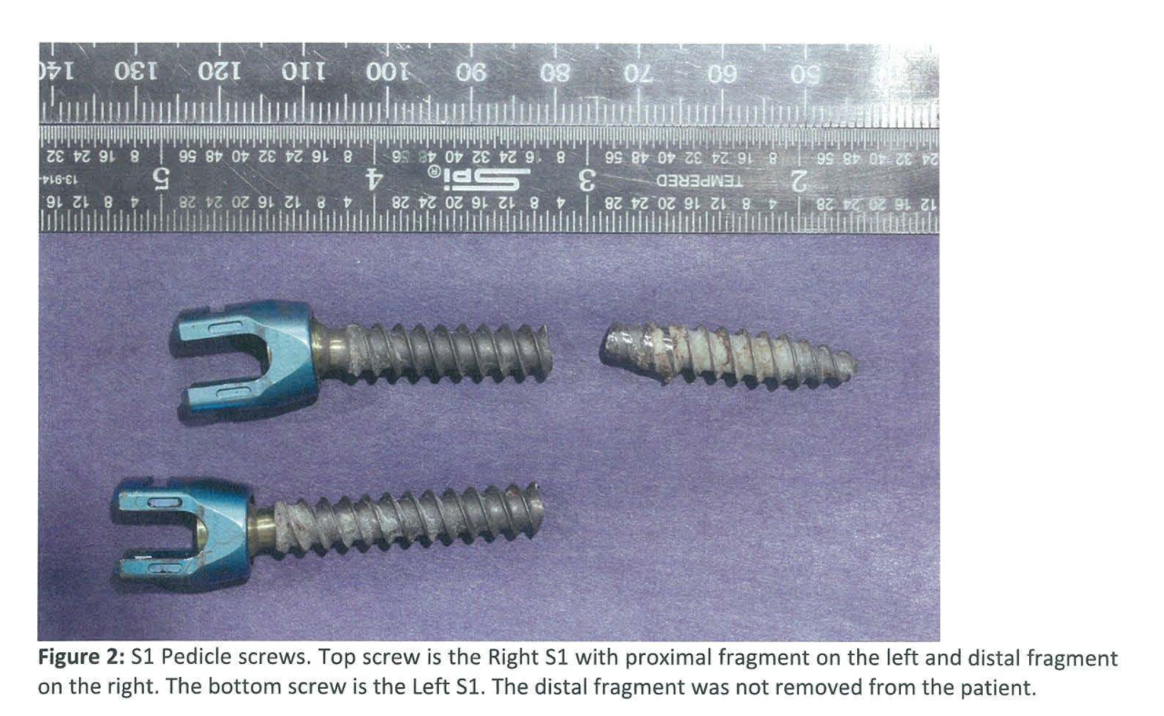 Injuries Mount as Sales Reps for Device Makers Cozy Up to Surgeons ...