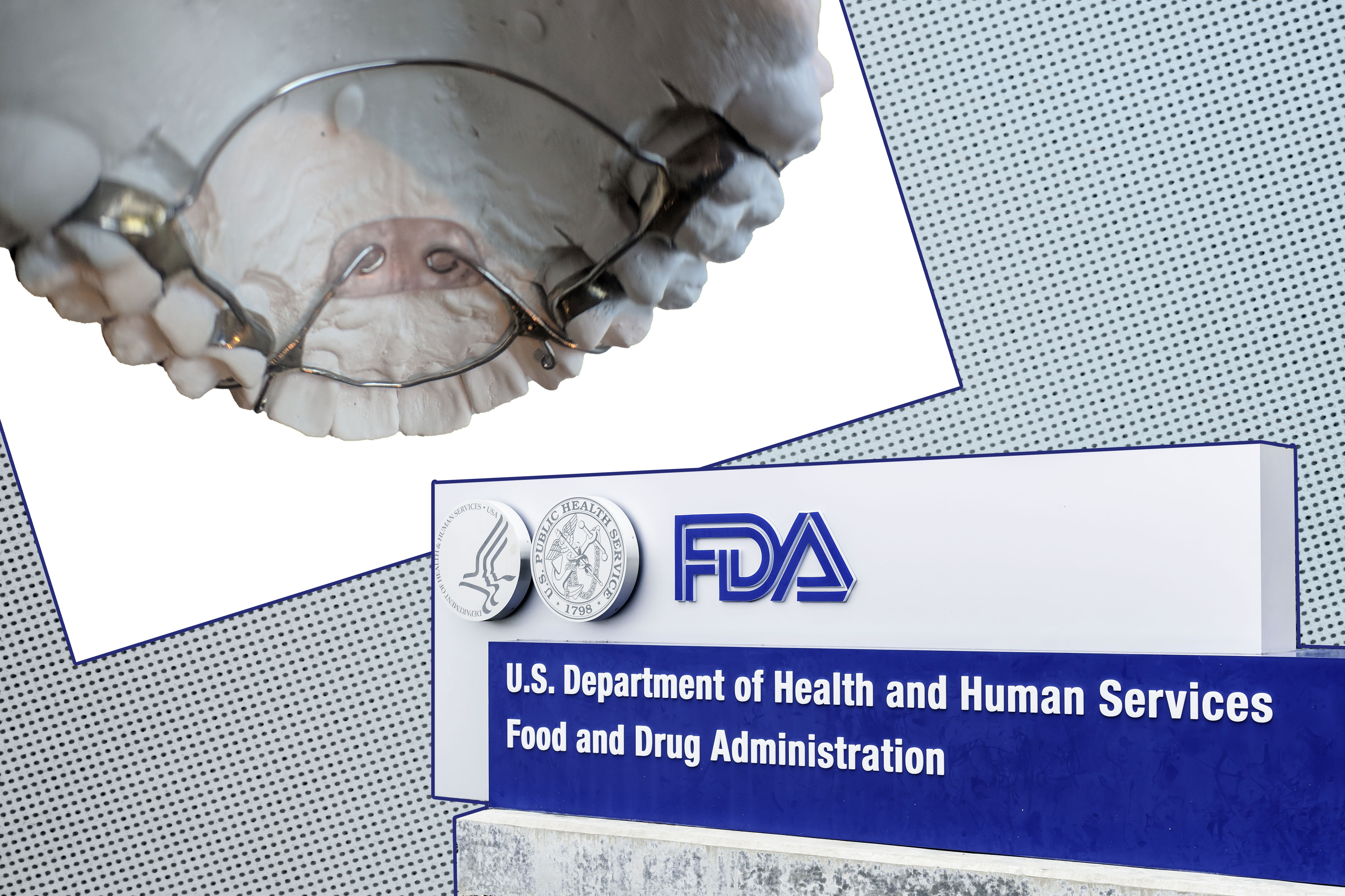 FDA Evaluates ‘Safety Concerns’ Over Dental Devices Featured in KHN-CBS ...