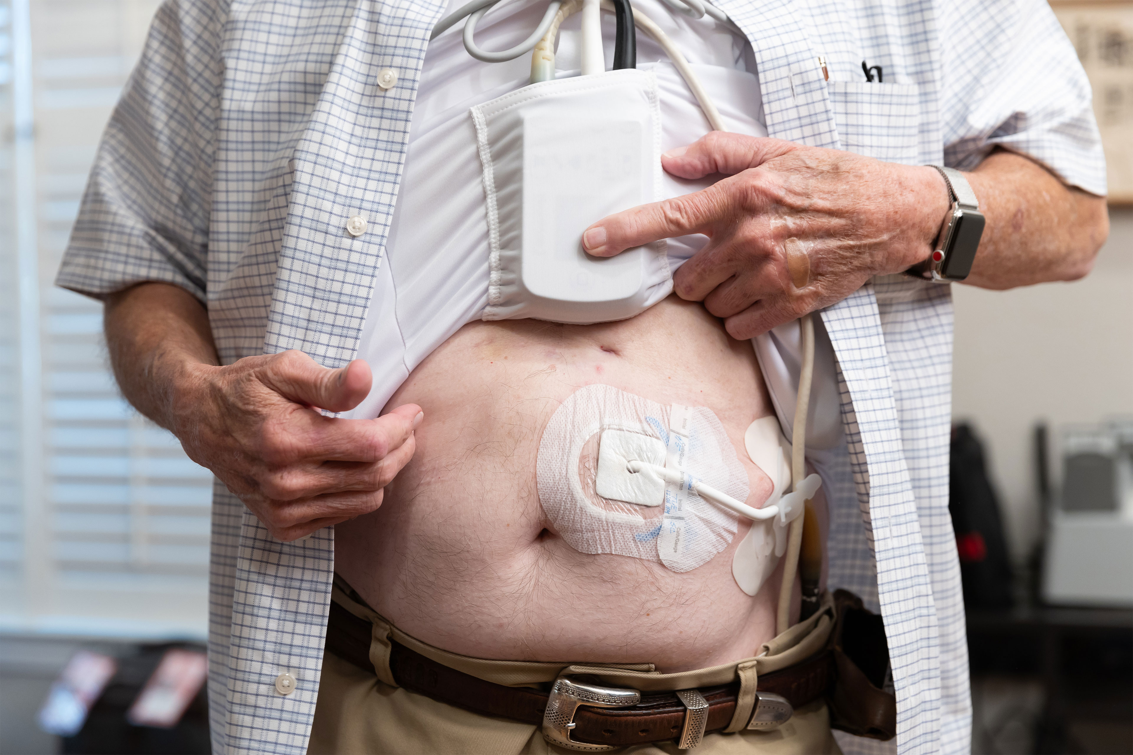 Patients Facing Death Are Opting for a Lifesaving Heart Device — But at ...