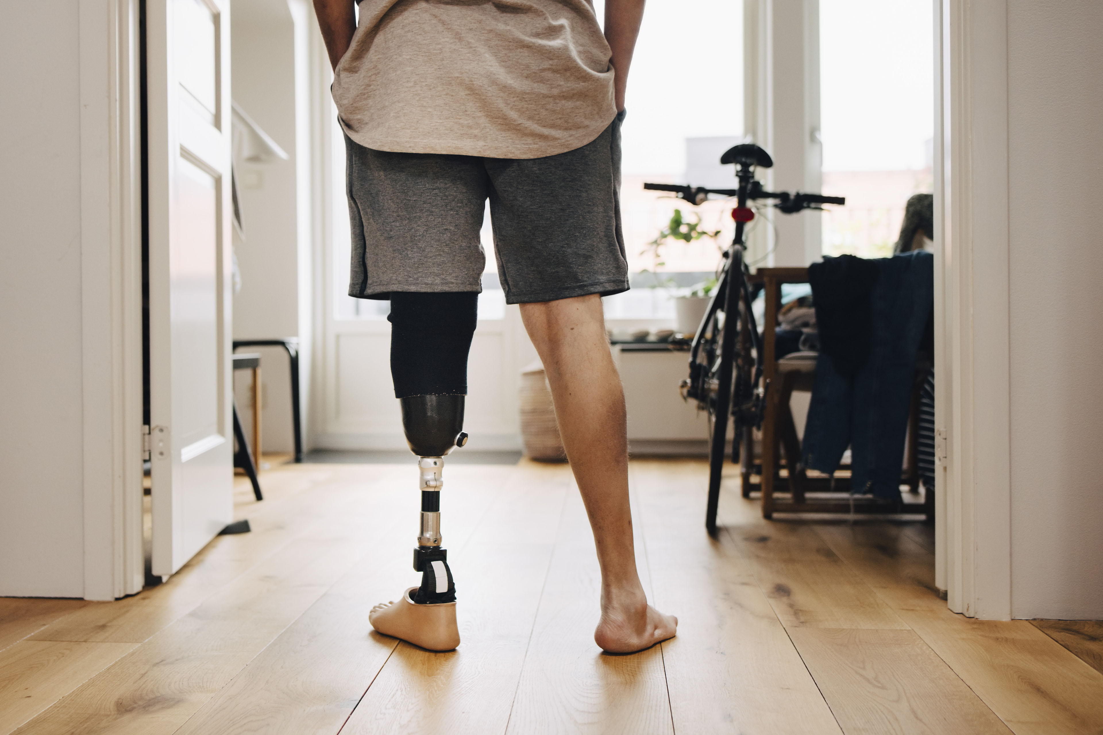 Health Insurers Limit Coverage of Prosthetic Limbs, Questioning Their ...