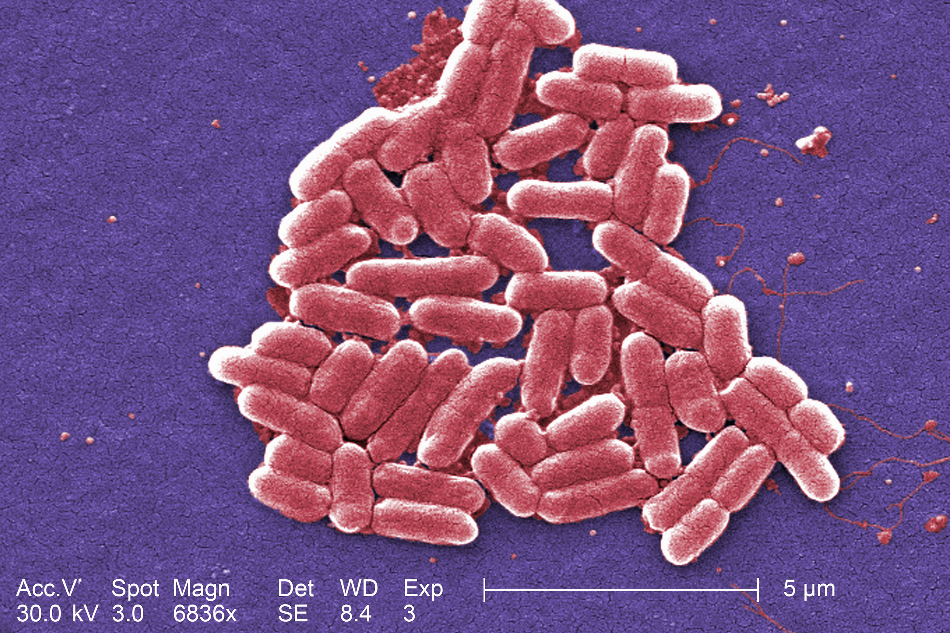 Silence on E. Coli Outbreak Highlights How Trump Team’s Changes ...