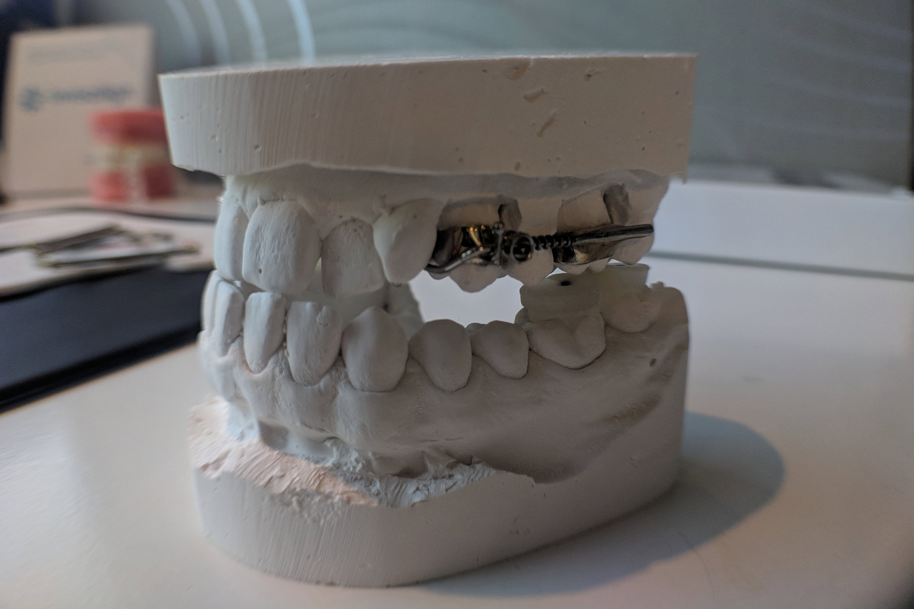 FDA Said It Never Inspected Dental Lab That Made Controversial AGGA ...